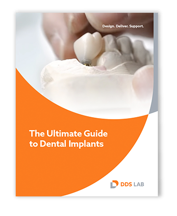 The Ultimate Guide To Dental Implants | Published